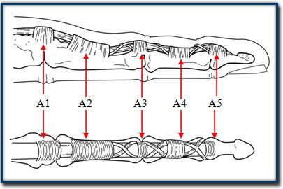 Sydney Hand Surgery » Trigger Finger
